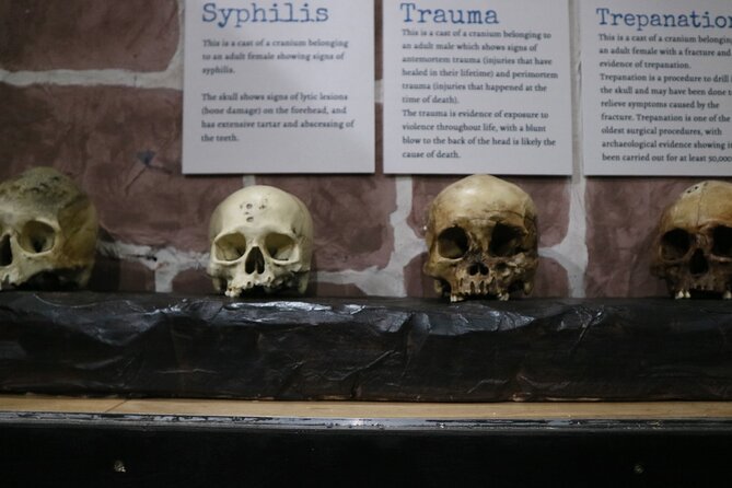 Admission Ticket to Sick To Death in Chester - FAQ