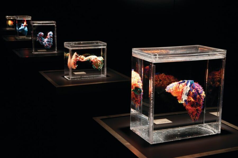 Las Vegas: BODIES | The Exhibition at the Luxor - What to Expect at Bodies...The Exhibition