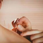Shenzhen: Acupuncture Experience with TCM Practitioner - What to Expect on the Day