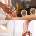Shanghai: Chinese Medicine Acupuncture and Cupping Session - The Value of Authentic Chinese Medicine